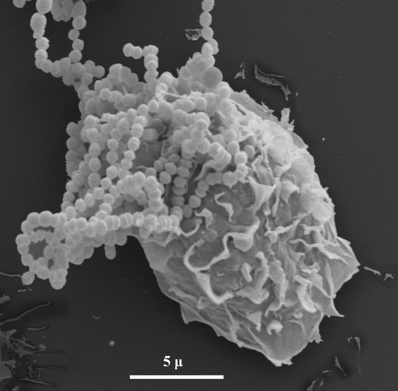 scanning electron microscope bacteria